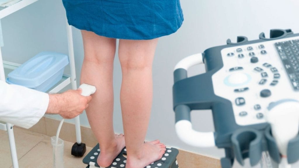 What is Vein Mapping Ultrasound for Varicose Vein Treatment? - Rema ...
